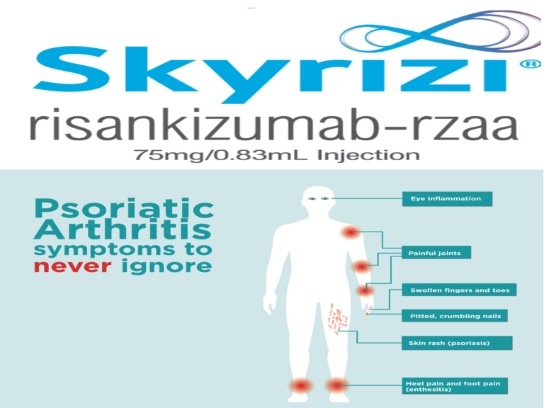 European Commission approves AbbVie’s Skyrizi (Risankizumab) to Treat ...