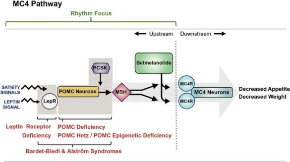 Rhythm Pharmaceuticals Announces FDA Approval of IMCIVREE ...